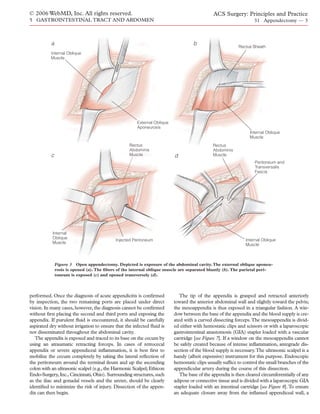 Acs0531 Appendectomy 2006 | PDF