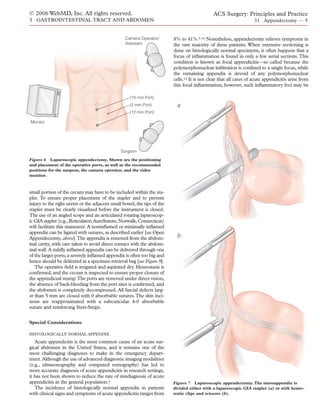 Acs0531 Appendectomy 2006 | PDF