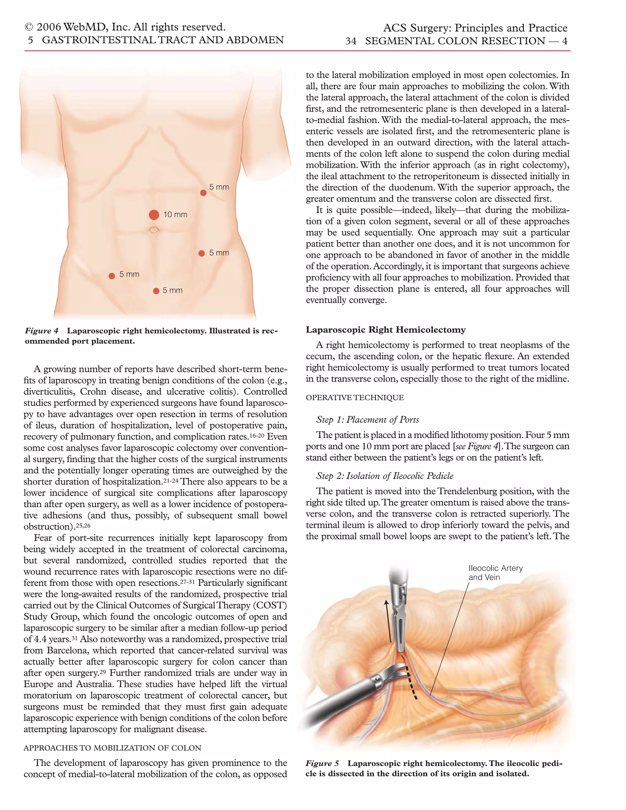 Acs0534 Segmental Colon Resection 2006 | PDF