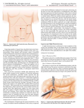 Acs0534 Segmental Colon Resection 2006 | PDF