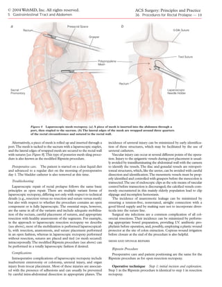 Acs0536 Procedures For Rectal Prolapse 2004 | PDF