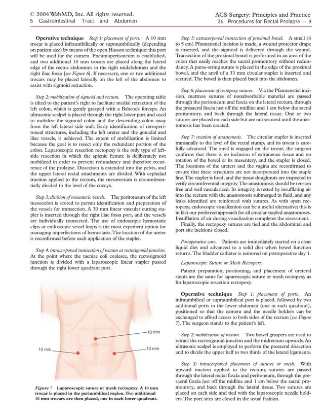 Acs0536 Procedures For Rectal Prolapse 2004 | PDF