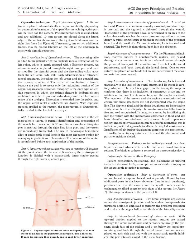 Acs0536 Procedures For Rectal Prolapse 2004