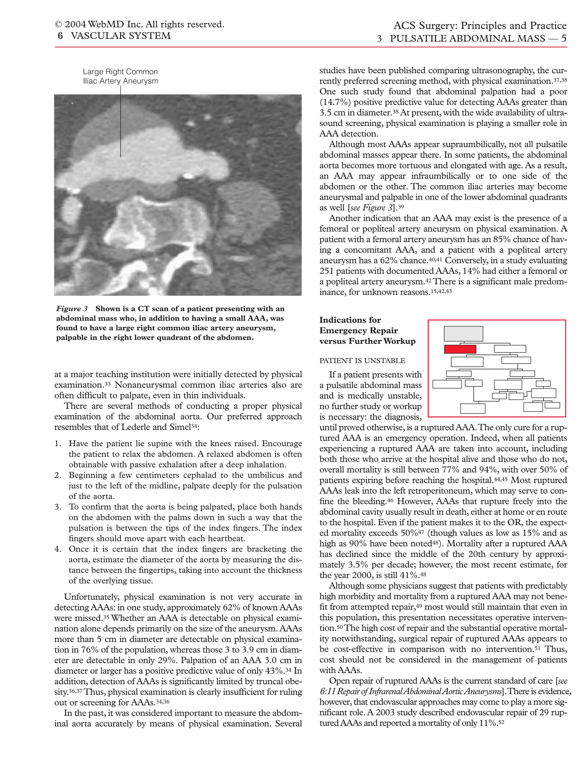 Acs0603 Pulsatile Abdominal Mass Pdf