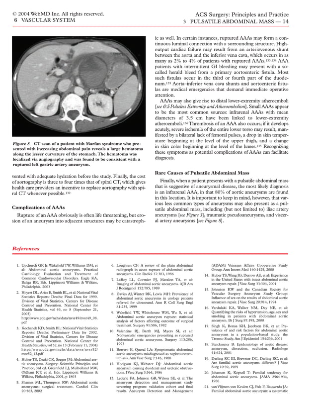 Acs0603 Pulsatile Abdominal Mass Pdf