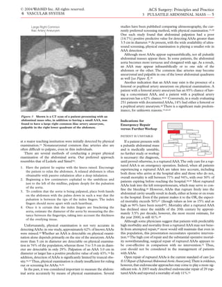 Acs0603 Pulsatile Abdominal Mass | PDF