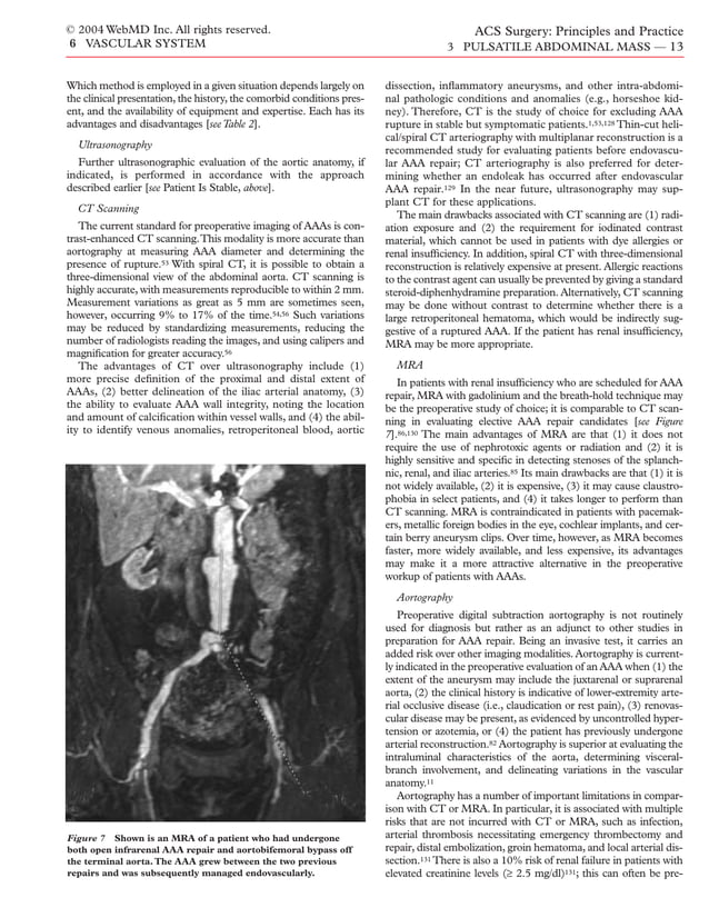 Acs0603 Pulsatile Abdominal Mass Pdf