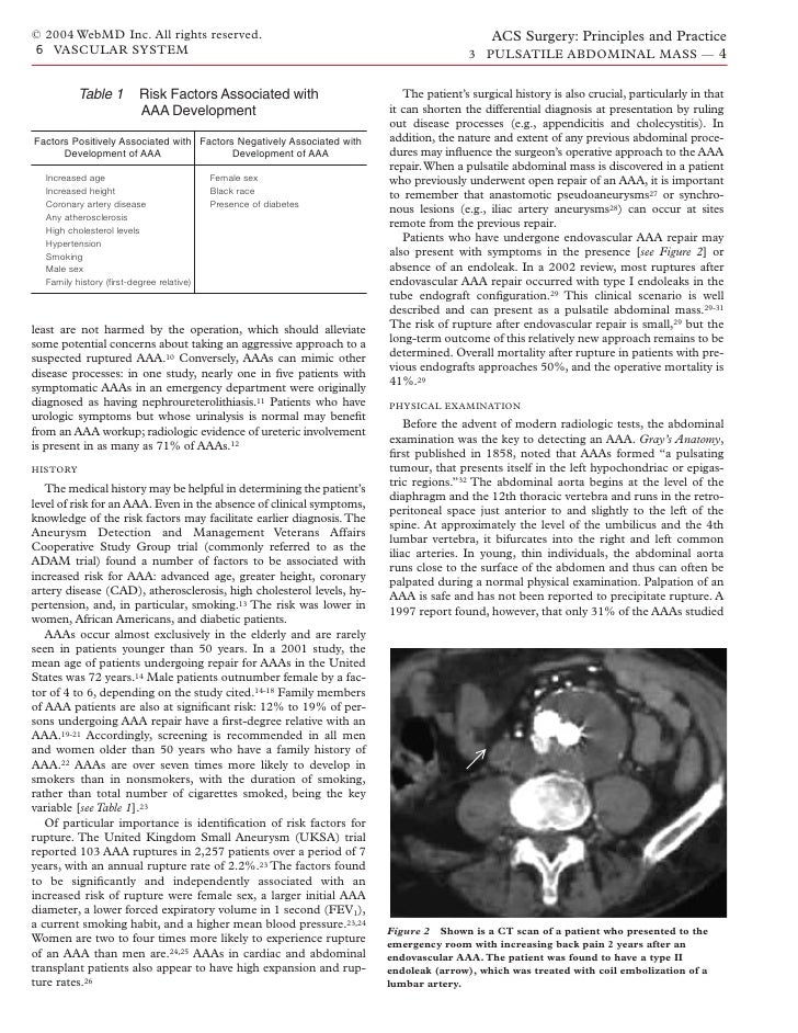Acs0603 Pulsatile Abdominal Mass