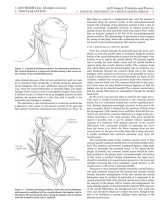 Acs0609 Surgical Treatment Of Carotid Artery Disease | PDF