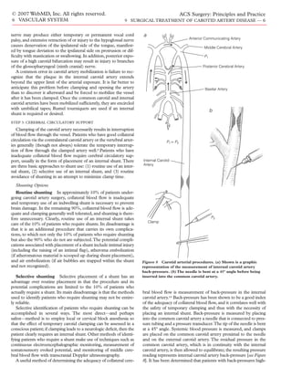 Acs0609 Surgical Treatment Of Carotid Artery Disease | PDF