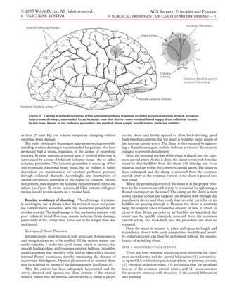 Acs0609 Surgical Treatment Of Carotid Artery Disease | PDF