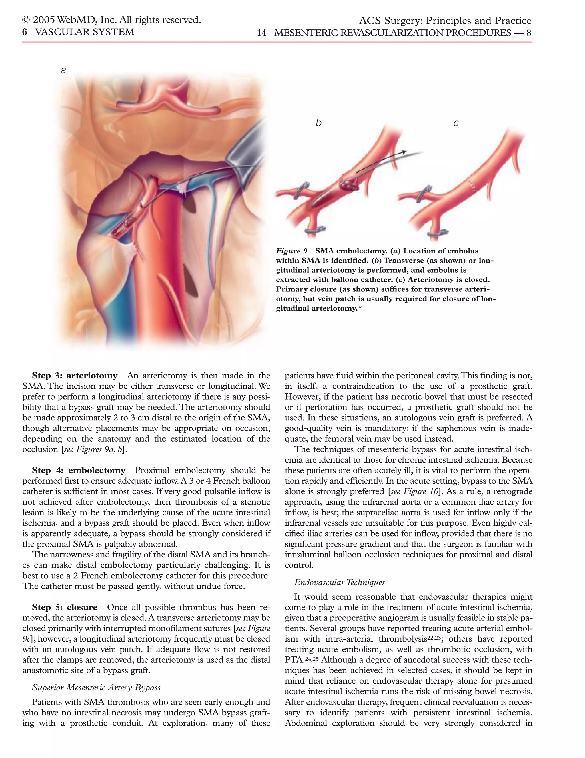 Acs0614 Mesenteric Revascularization Procedures | PDF
