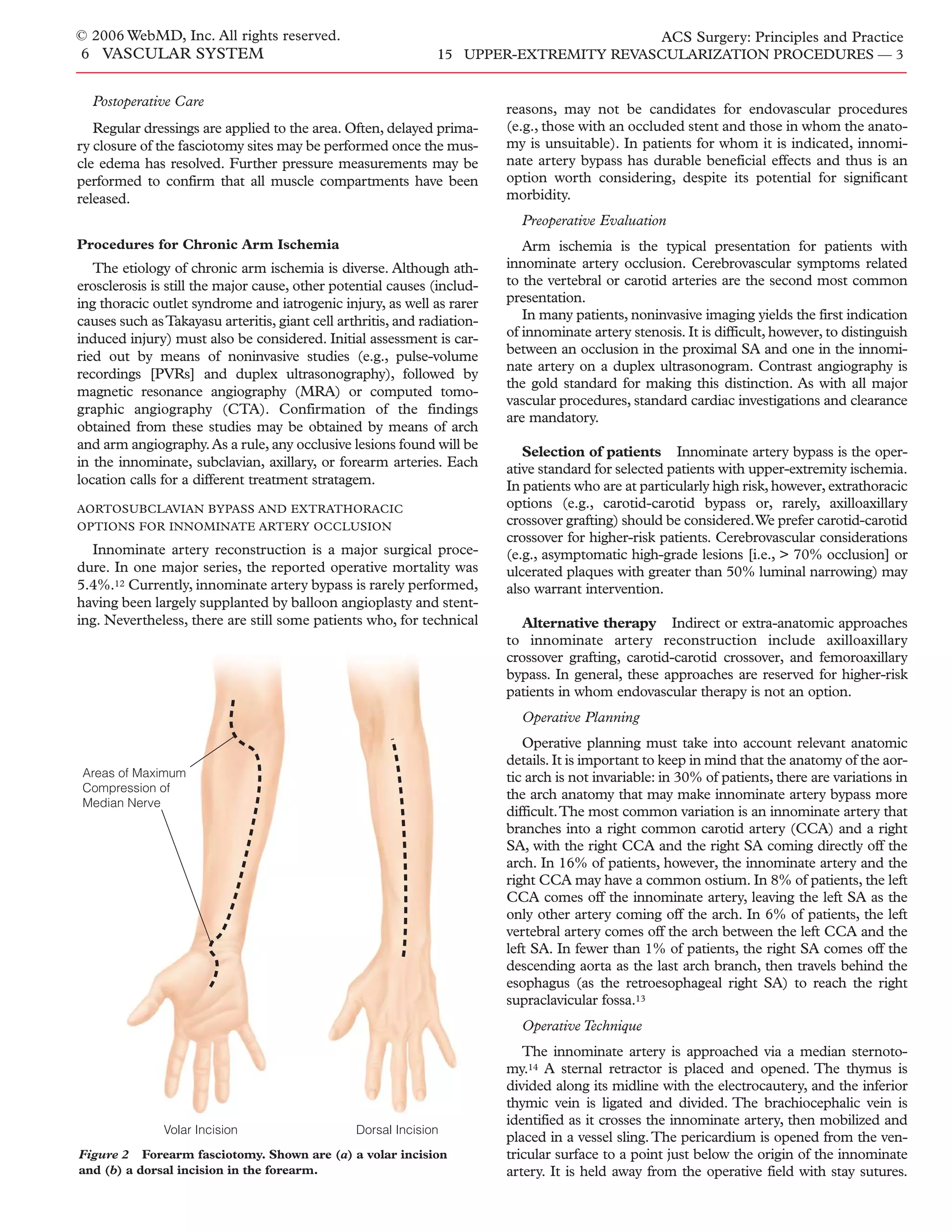 Acs0615 Upper Extremity Revascularization Procedures | PDF