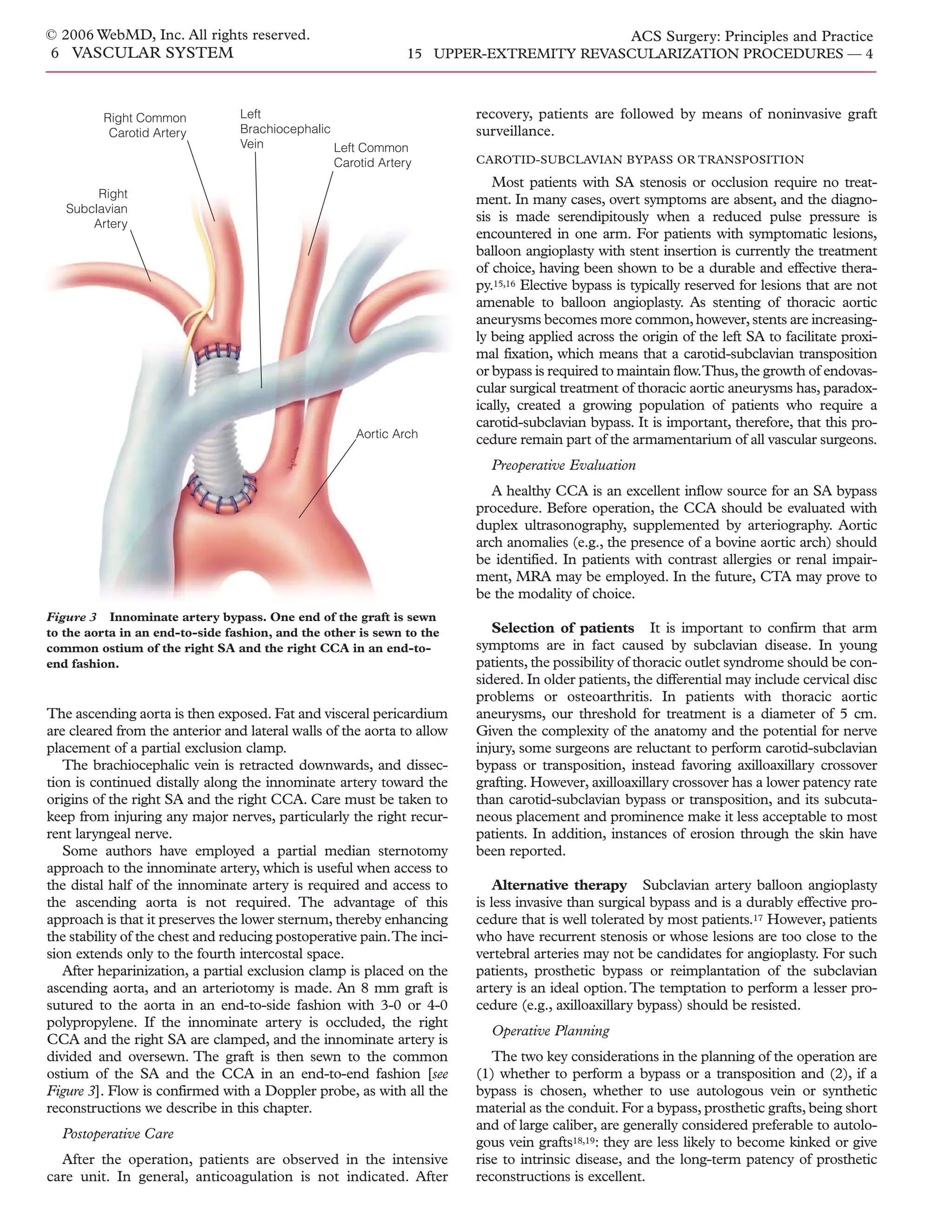 Acs0615 Upper Extremity Revascularization Procedures | PDF