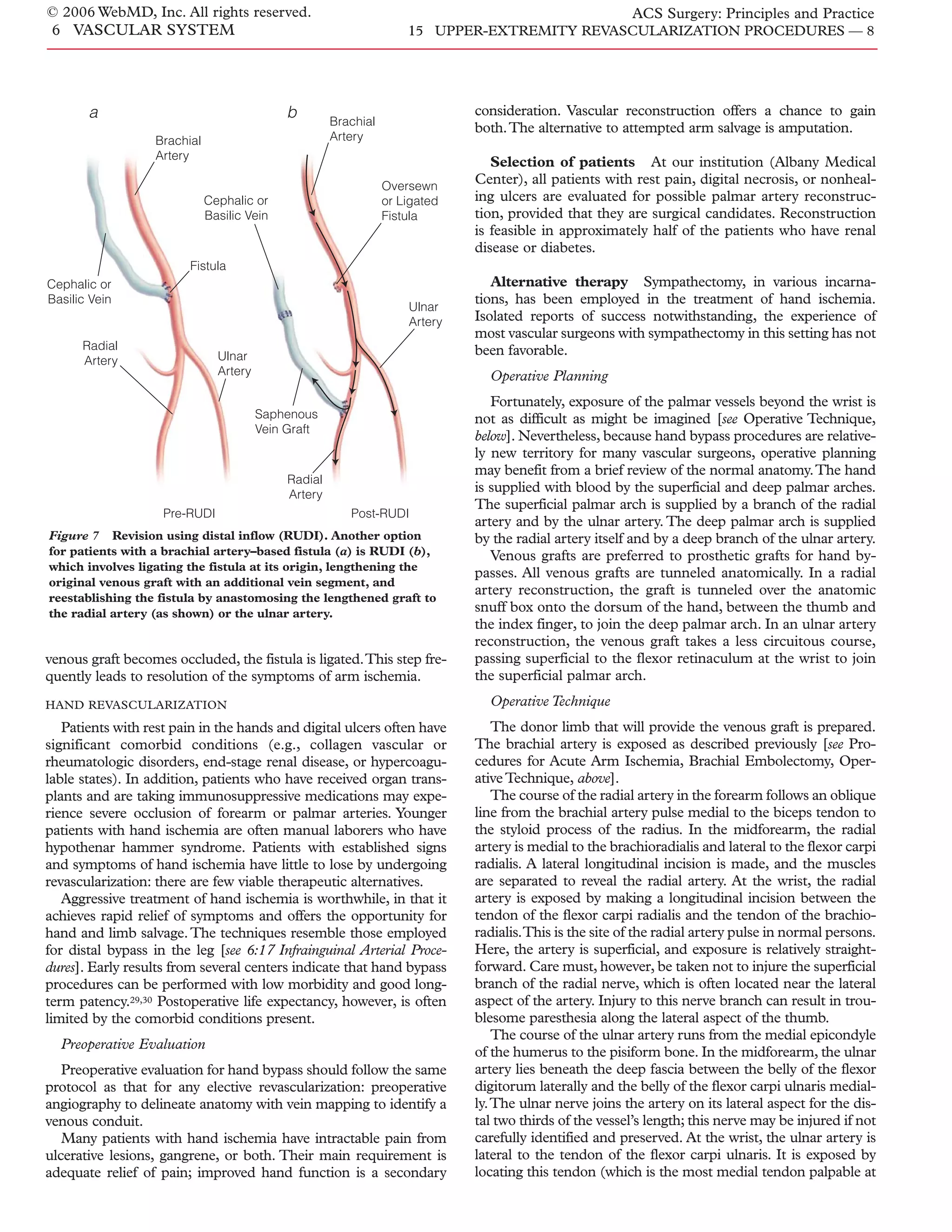 Acs0615 Upper Extremity Revascularization Procedures | PDF