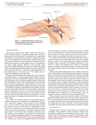 Acs0615 Upper Extremity Revascularization Procedures | PDF