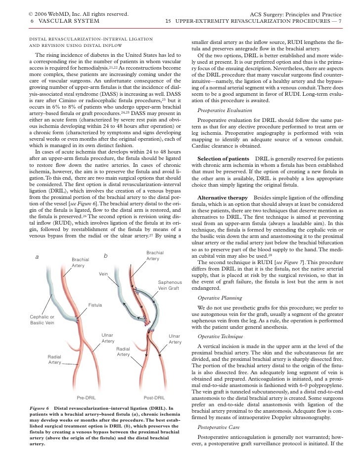 Acs0615 Upper Extremity Revascularization Procedures