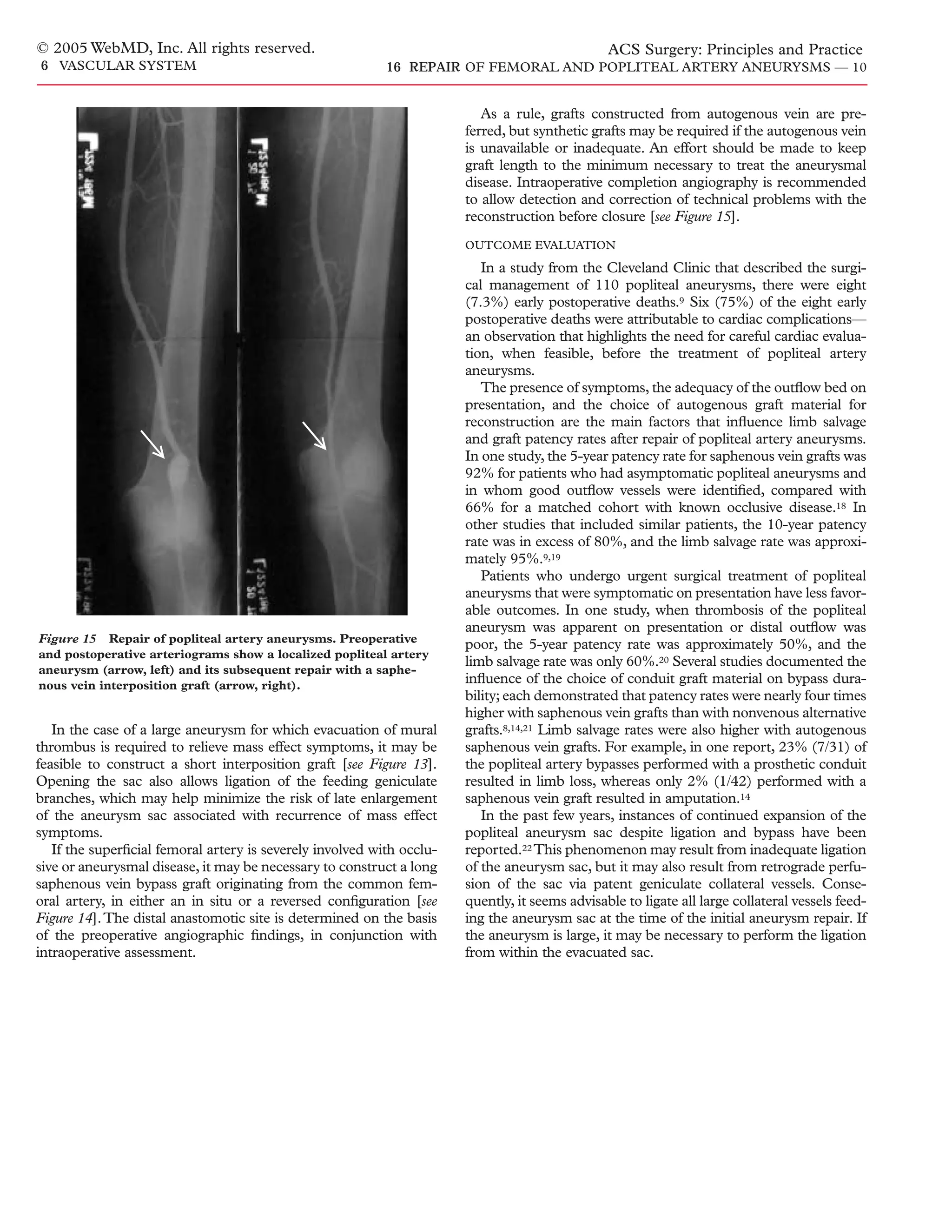 Acs0616 Repair Of Femoral And Popliteal Artery Aneurysms | PDF