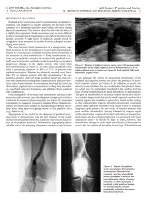 Acs0616 Repair Of Femoral And Popliteal Artery Aneurysms | PDF