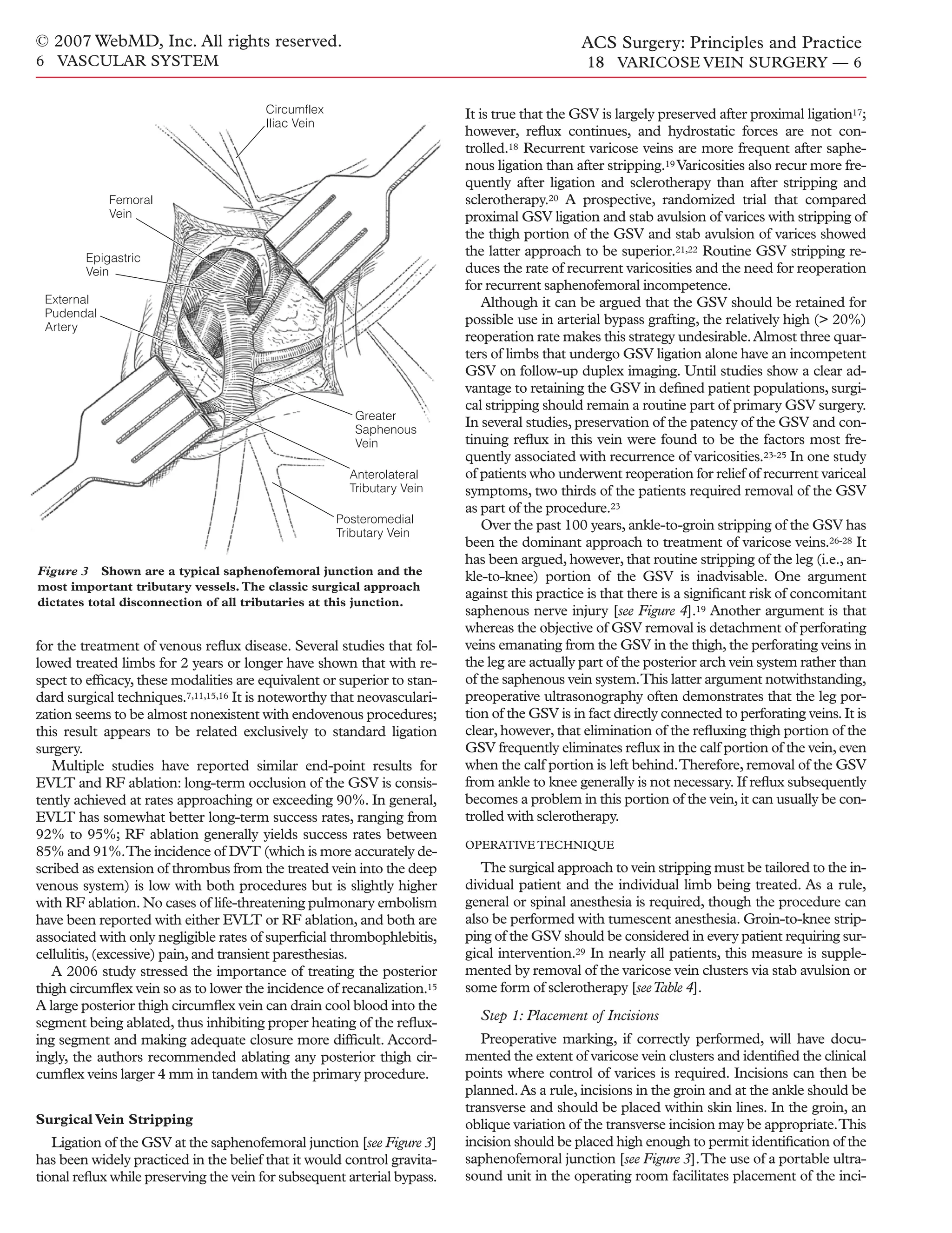 Acs0618 Varicose Vein Surgery | PDF