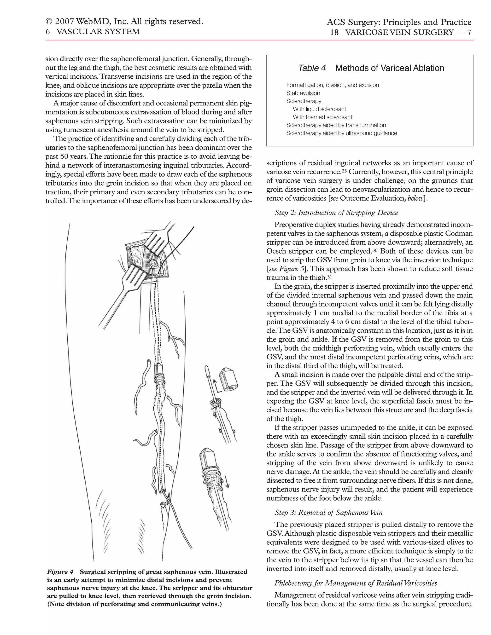 Acs0618 Varicose Vein Surgery | PDF