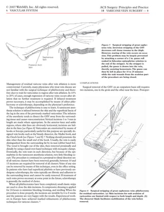 Acs0618 Varicose Vein Surgery | PDF | Blood Disorders | Diseases and ...