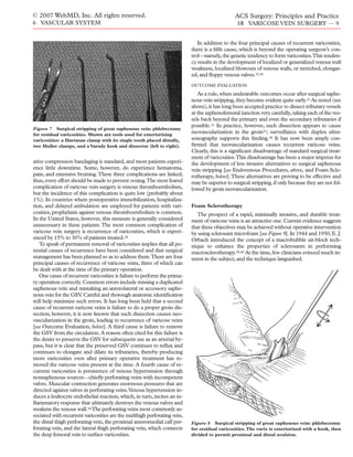 Acs0618 Varicose Vein Surgery | PDF | Blood Disorders | Diseases and ...