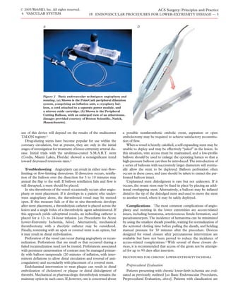 Acs0619 Endovascular Procedures For Lower Extremity Disease | PDF