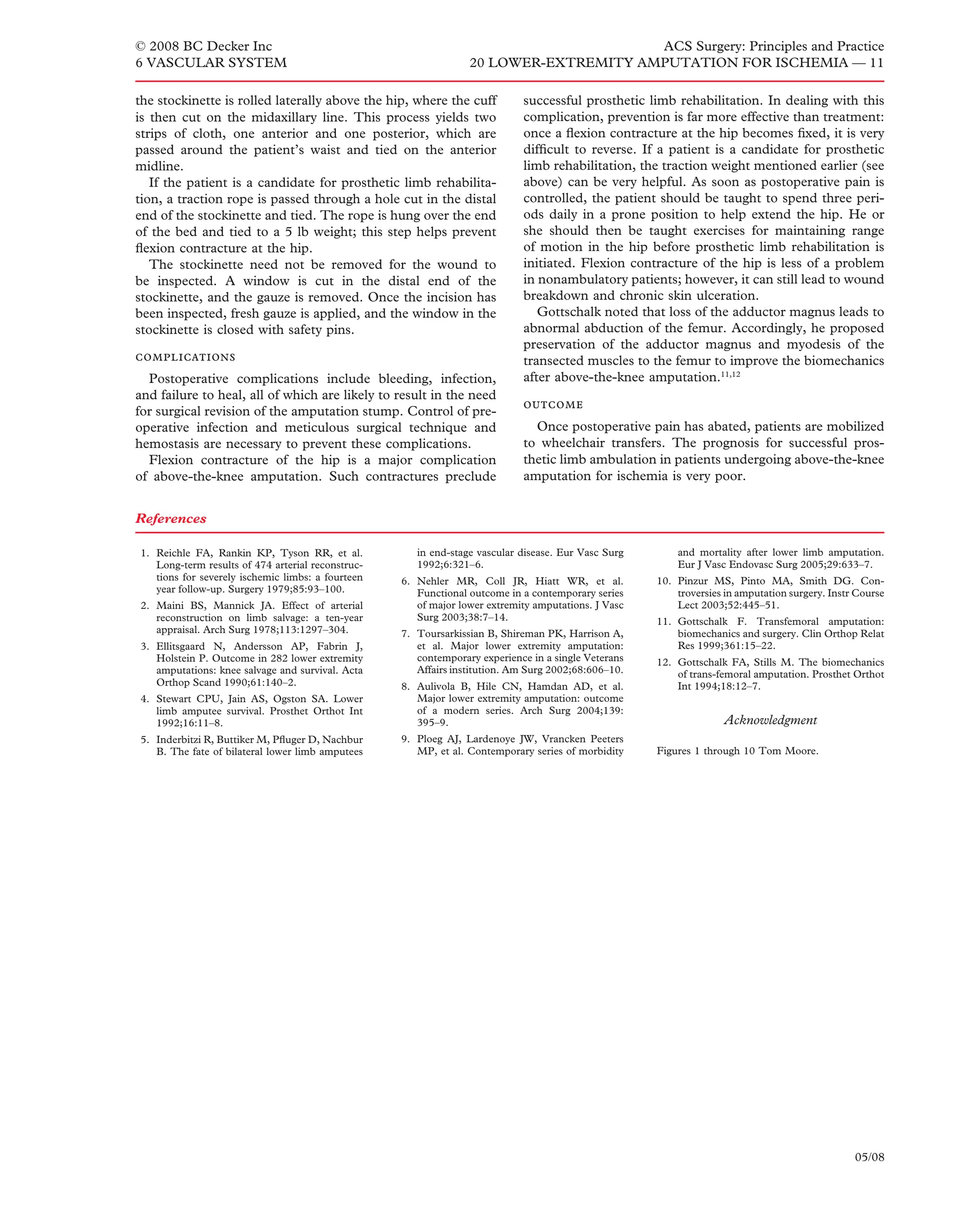 Acs0620 Lower Extremity Amputation For Ischemia | PDF