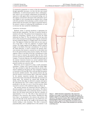 Acs0620 Lower Extremity Amputation For Ischemia | PDF
