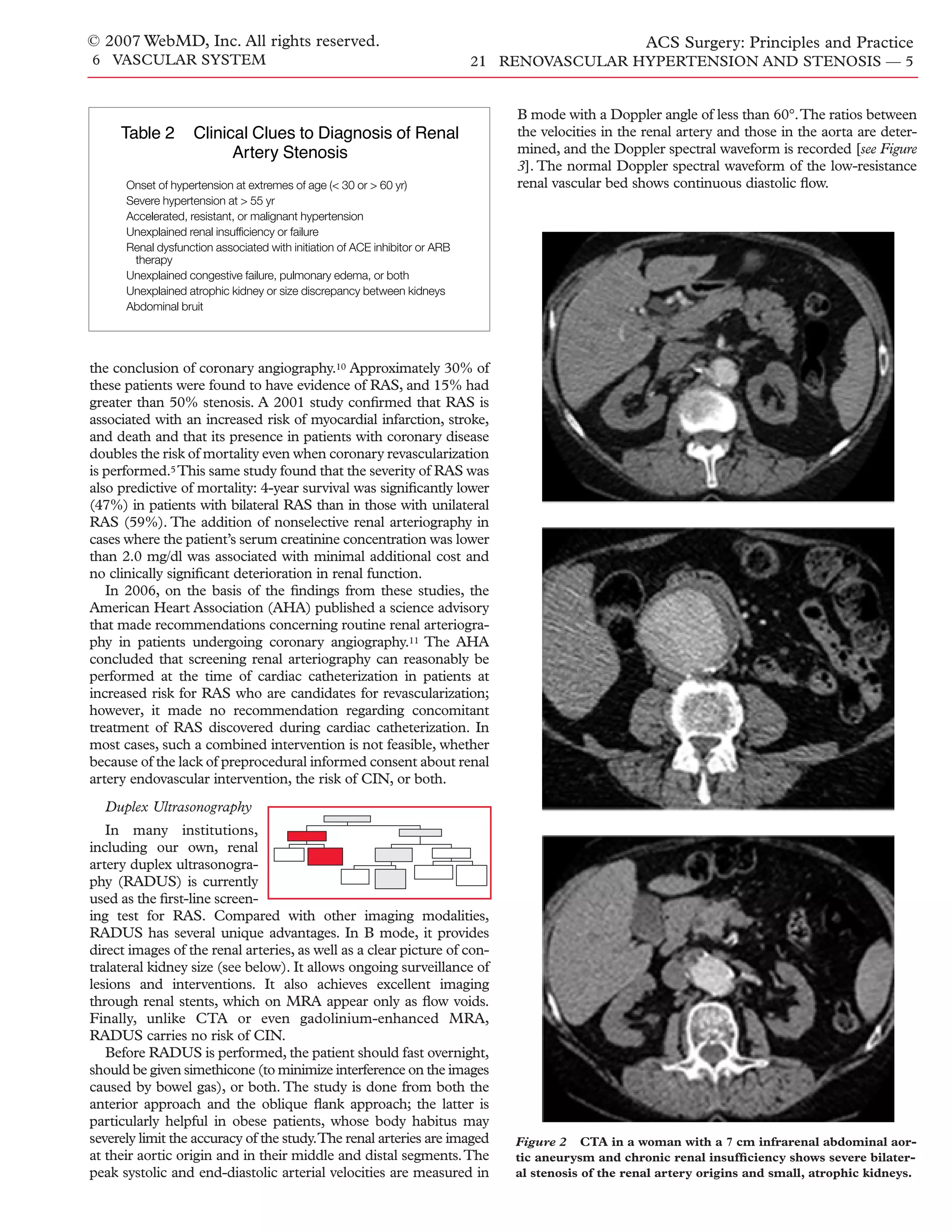 Acs0621 Renovascular Hypertension And Stenosis | PDF
