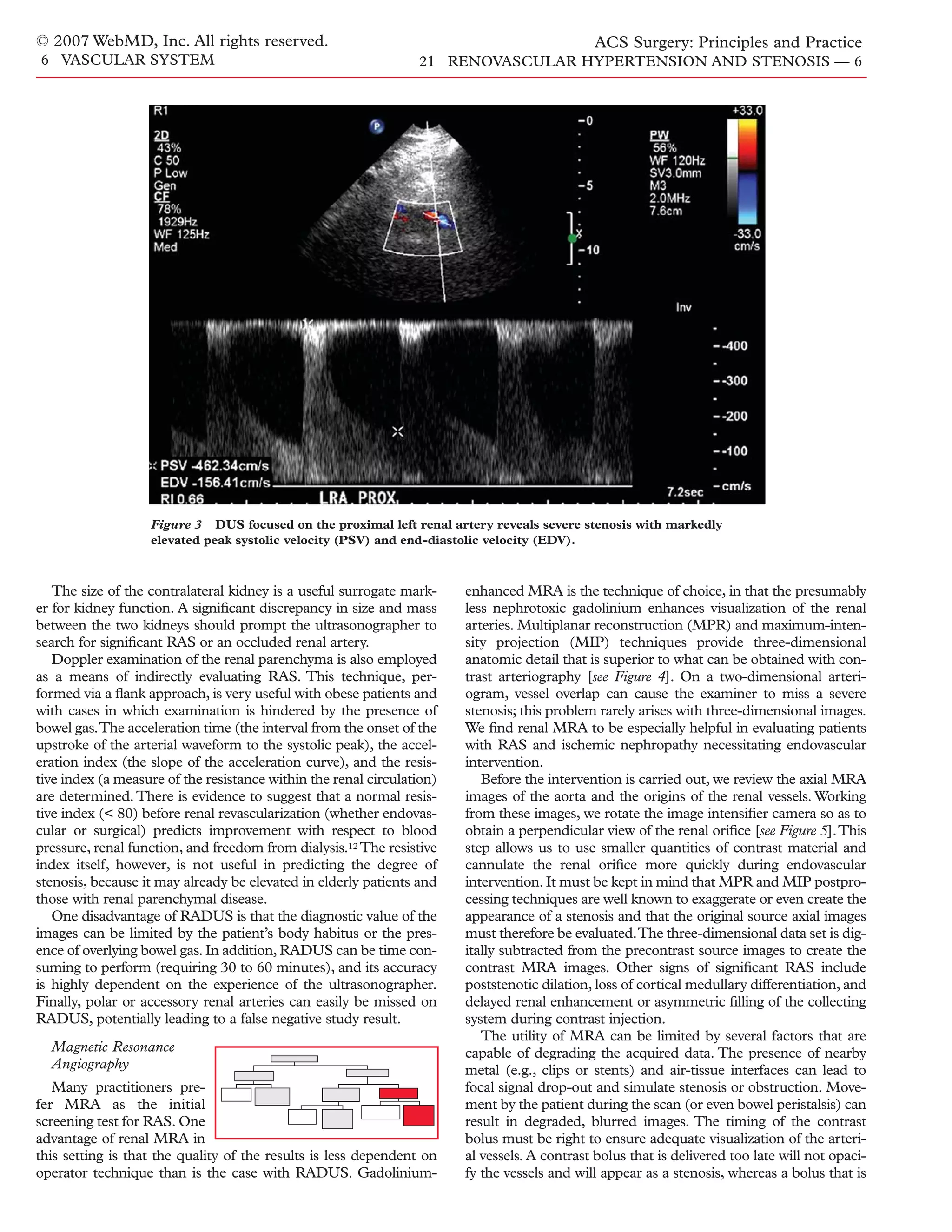 Acs0621 Renovascular Hypertension And Stenosis | PDF