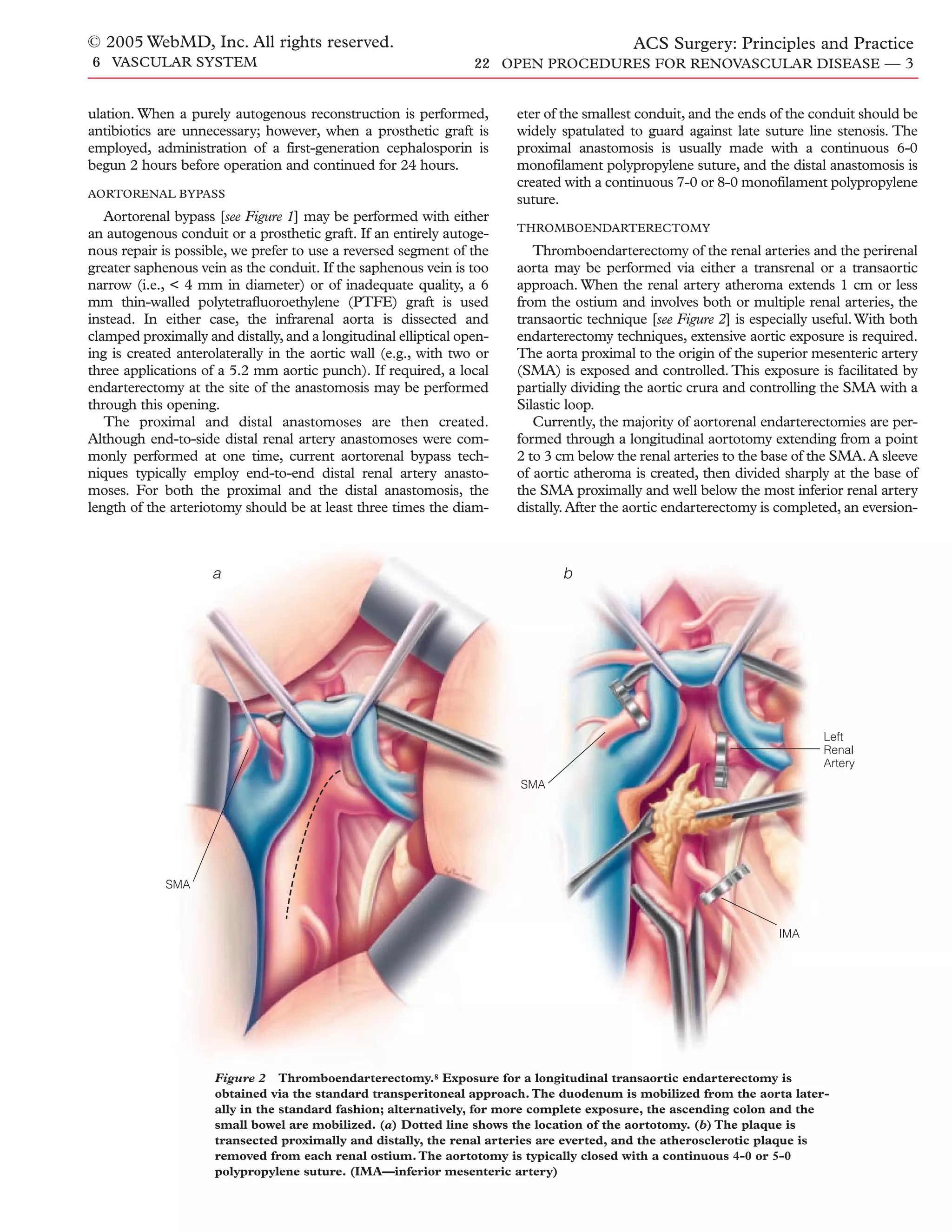 Acs0622 Open Procedures For Renovascular Disease | PDF