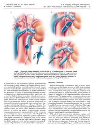 Acs0622 Open Procedures For Renovascular Disease | PDF