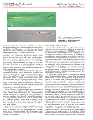 Acs0623 Endovascular Procedures For Renovascular Disease | PDF