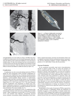 Acs0623 Endovascular Procedures For Renovascular Disease | PDF