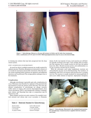Acs0625 Sclerotherapy | PDF