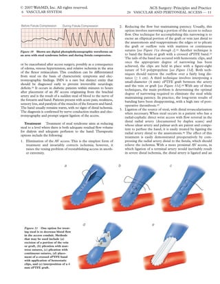 Acs0626 Medical Management Of Vascular Disease | PDF