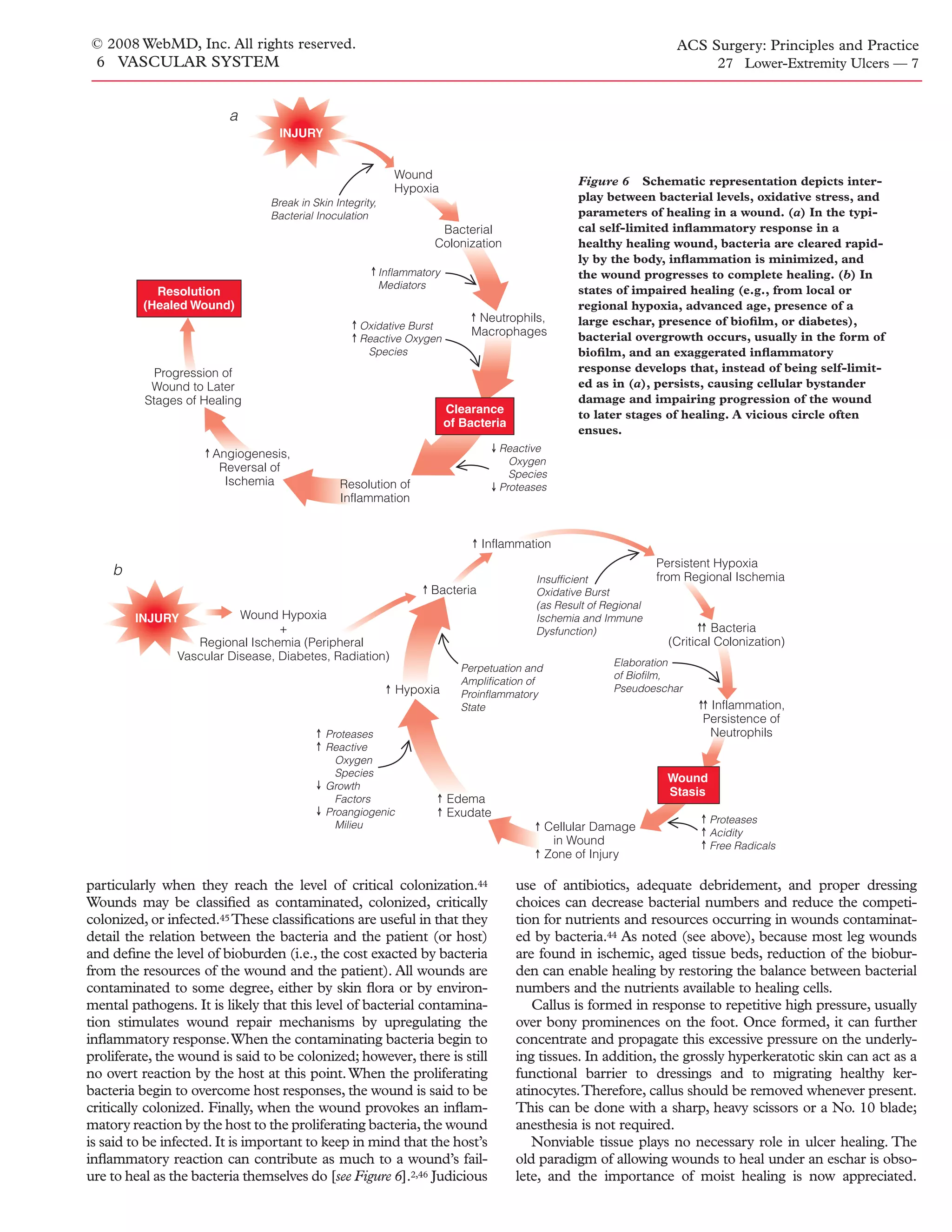 Acs0627 Lower Extremity Ulcers | PDF