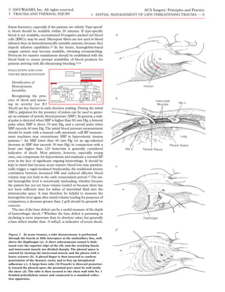Acs0701 Initial Management Of Life Threatening Trauma | PDF