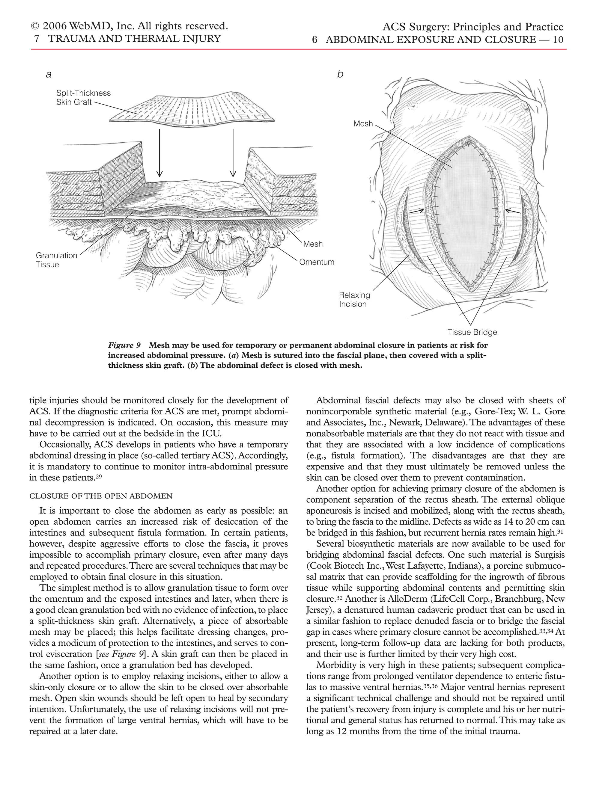 Acs0706 Operative Exposure Of Abdominal Injuries And Closure Of The ...