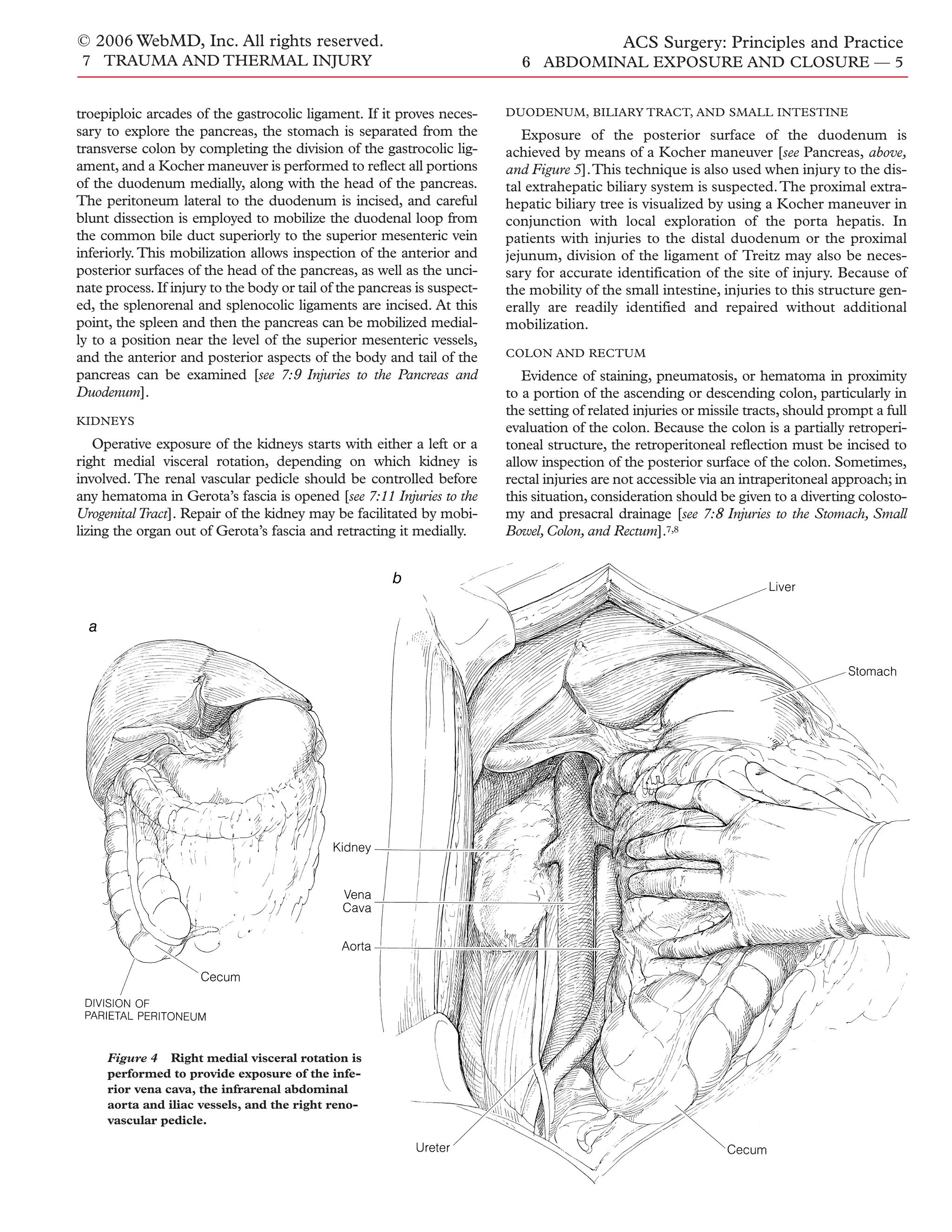 Acs0706 Operative Exposure Of Abdominal Injuries And Closure Of The ...