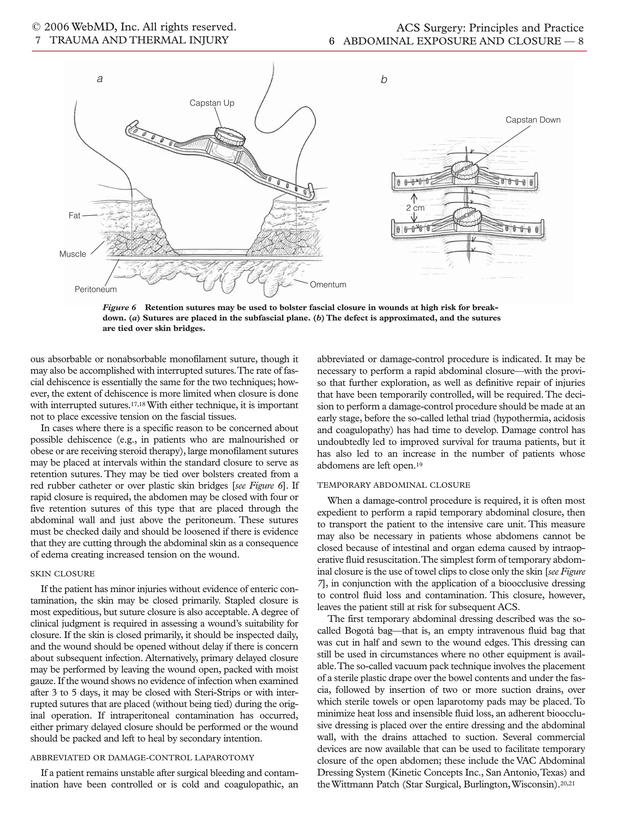 Acs0706 Operative Exposure Of Abdominal Injuries And Closure Of The ...