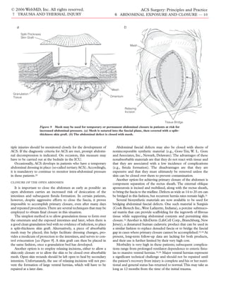 Acs0706 Operative Exposure Of Abdominal Injuries And Closure Of The ...