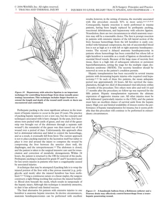 Acs0707 Injuries To The Liver, Biliary Tract, Spleen, And Diaphragm | PDF