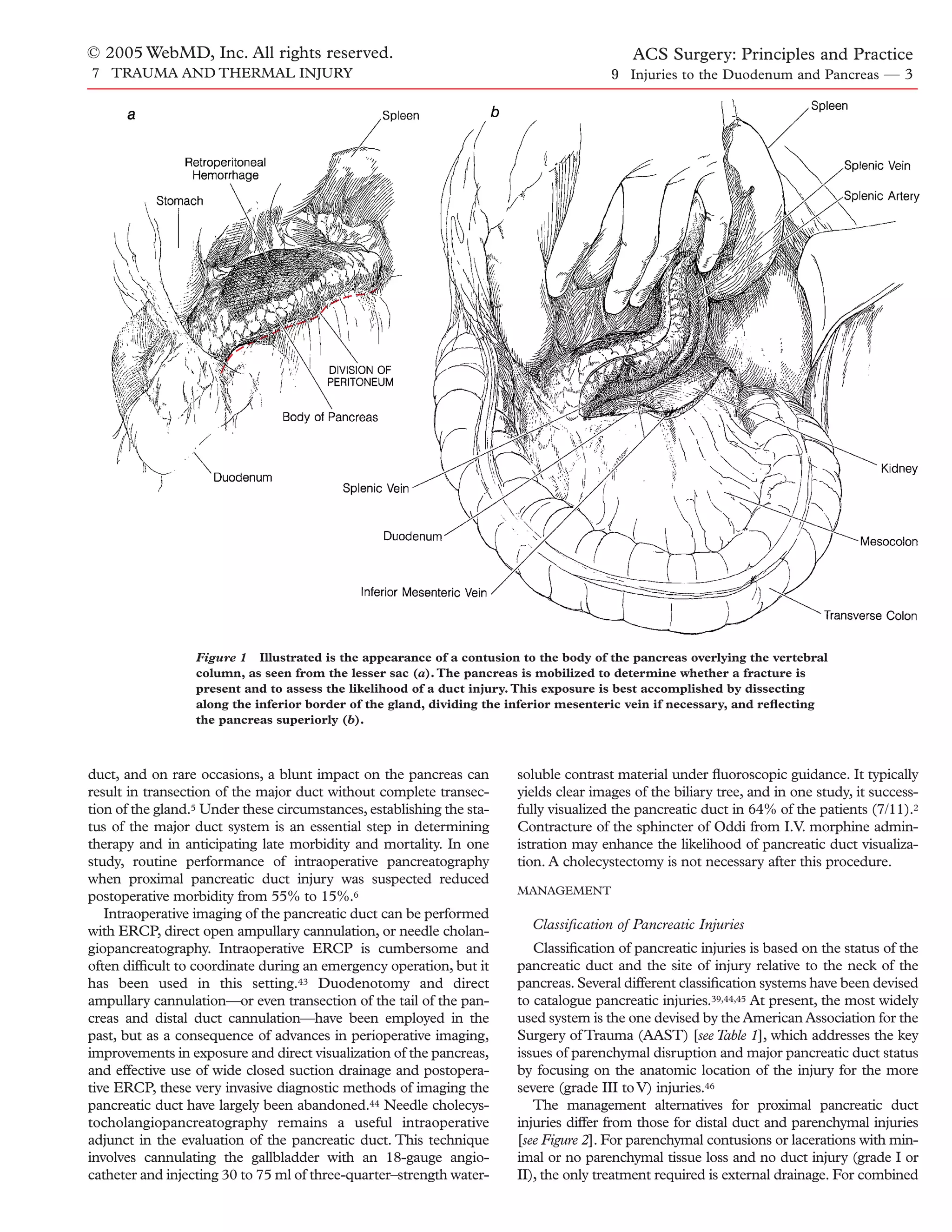 Acs0709 Injuries To The Pancreas And Duodenum | PDF