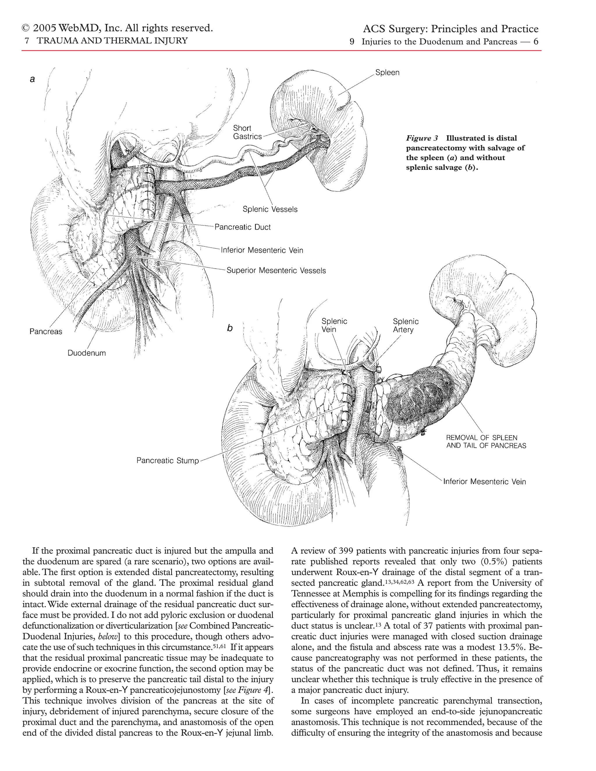 Acs0709 Injuries To The Pancreas And Duodenum | PDF