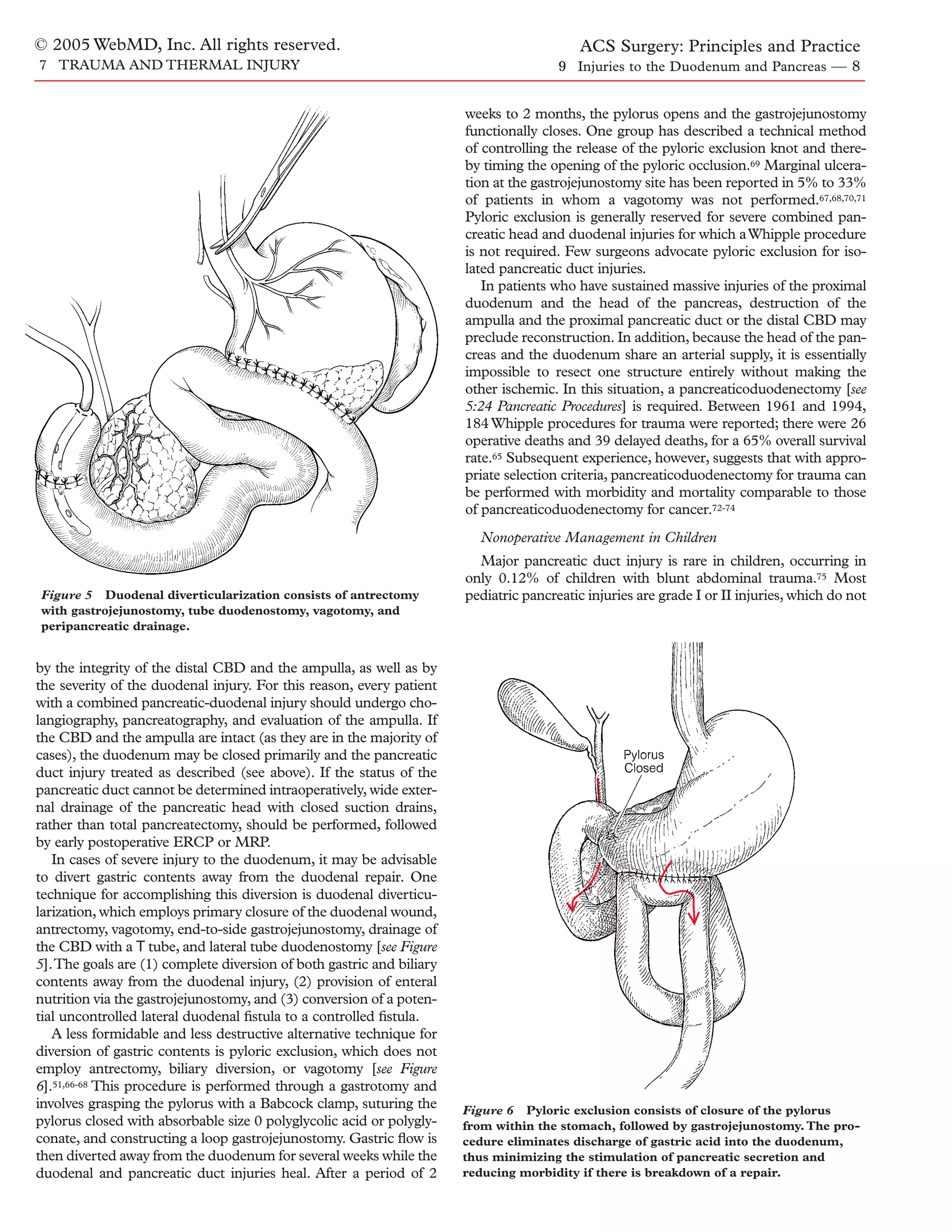 Acs0709 Injuries To The Pancreas And Duodenum | PDF