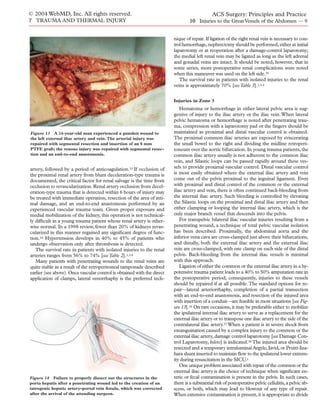 Acs0710 Injuries To The Great Vessels Of The Abdomen | PDF