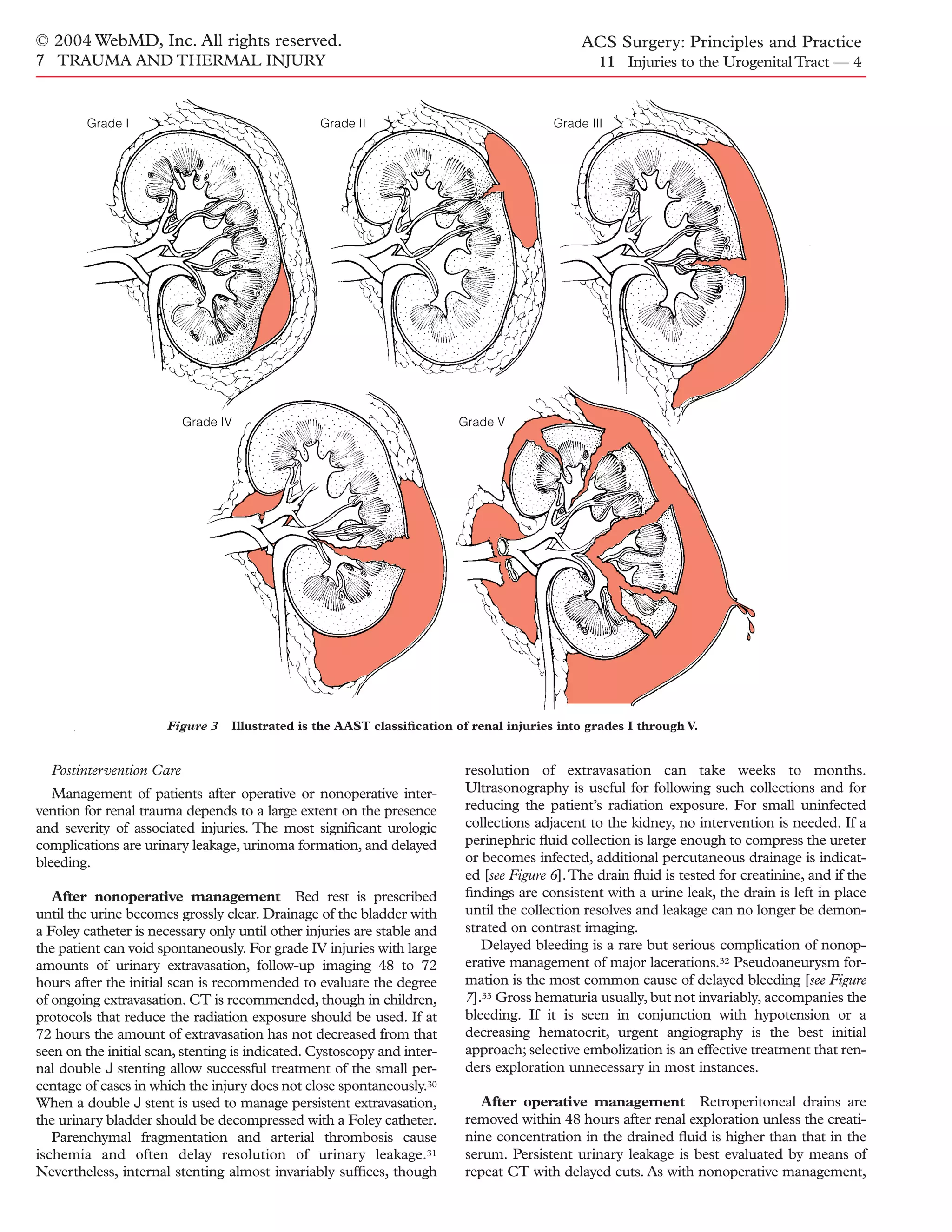 Acs0711 Injuries To The Urogenital Tract | PDF
